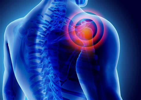 Tratamiento fisioterapéutico para Síndrome de dolor miofascial pélvico