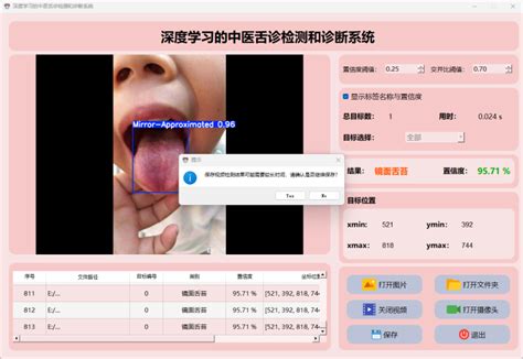 深度学习的中医舌诊检测诊断系统研究与实现pyqt5界面数据集训练代码 中猿创新 7zcode