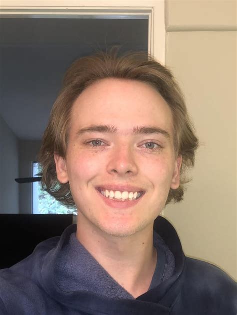 What Should I Do About My Big Ass Forehead R Hairstyleadvice