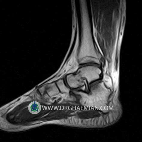 ام آر آی مفاصل تحتانی چیست و چرا انجام می شود؟ مرکز تصویر برداری دکتر