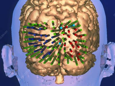Functional Map Of The Brain S Visual Cortex Areas Stock Image P335 0049 Science Photo Library