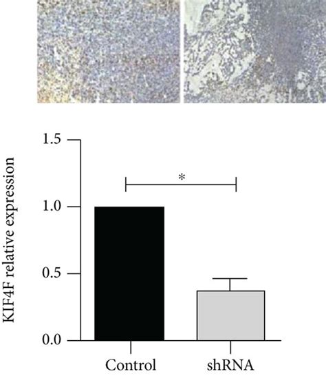 In Vivo Kif4a Knockdown Inhibits Tumor Growth A B Tumor Volume In