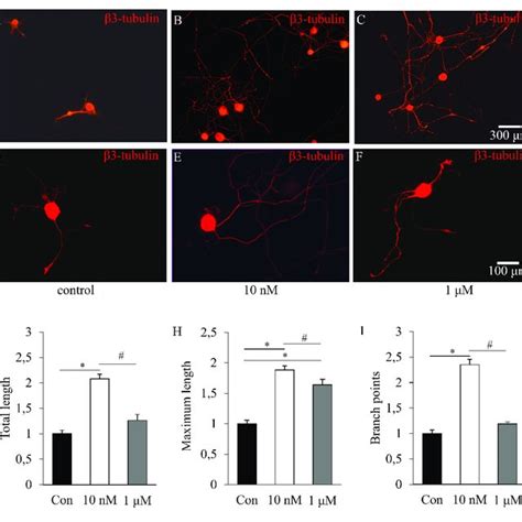 The Effects Of Insulin On Neurite Outgrowth Of Cultured Adult Rat