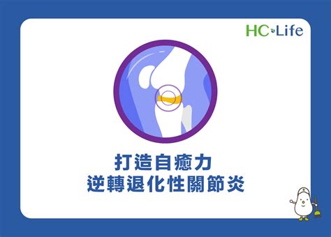 告別退化性關節炎，關節咔咔響、膝蓋卡卡痛？專家教你 3 招打造自癒力 Hc 康見精準健康