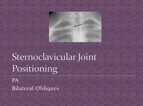 Radiography Of Sternoclavicular Jts