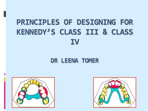 Designing For Kennedys Cl Iii And Iv Ppt