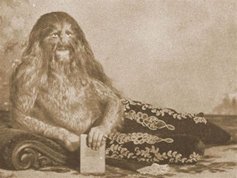The Fascinating True Stories Behind 10 Famous ‘freak Show Performers