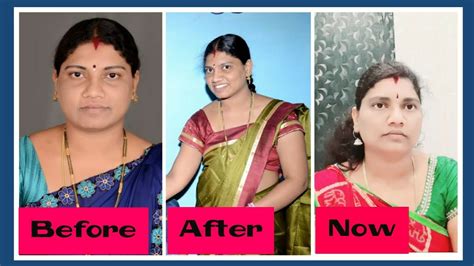 My Weightloss Journey Story Youtube