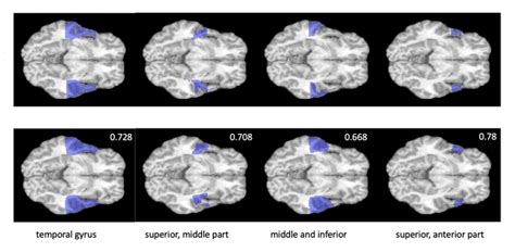 Visualization Of Ground Truth Segmentations Top And Lcs Predictions Download Scientific