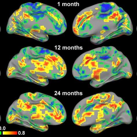Relationships Between Intersubject Variability Of The Brains