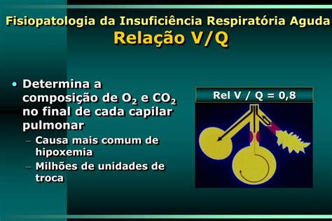 PPT Insuficiência Respiratória Aguda PowerPoint Presentation free