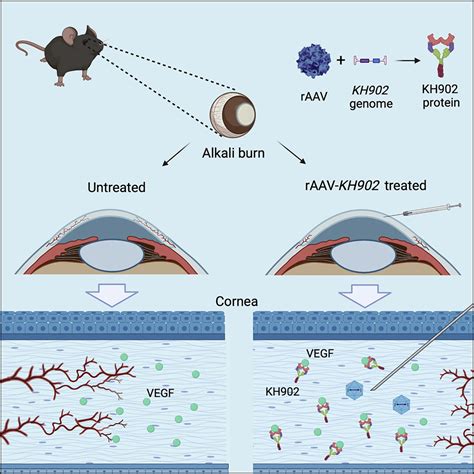 Corneal Neovascularization