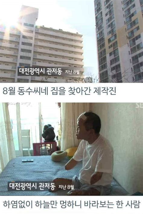 병원의 실수로 하루아침에 사지절단 된 가장 인스티즈 instiz 이슈 카테고리