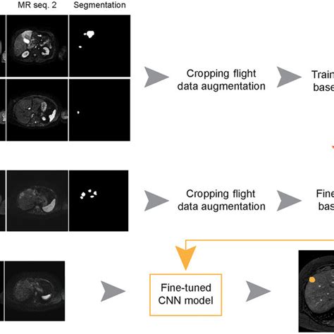 proposed lesion quantification framework shown with the liver mri as