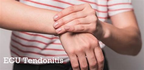 Extensor Carpi Ulnaris Tendonitis Causes And Treatment