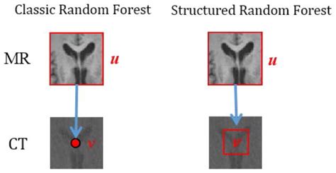 Estimating Ct Image From Mri Data Using Structured Random Forest And