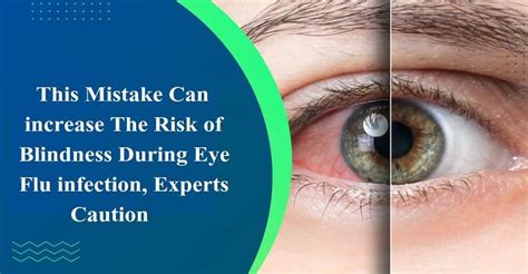 Prevalence Of Conjunctivitis This Mistake Can Increase The Risk Of