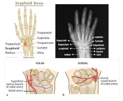Scaphoid Fractures — Kwak Talk