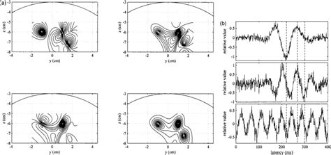 The Results Obtained Using The Minimum Variance Beamformer A Download Scientific Diagram