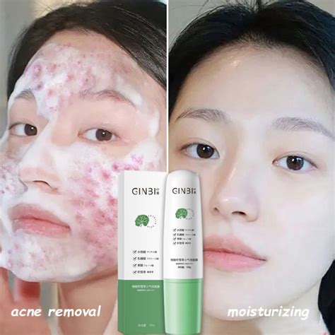 Centella Asiatica Mdb Small Bubble Mask Acne Removal Blackhead Whitening Moisturizing Lazada