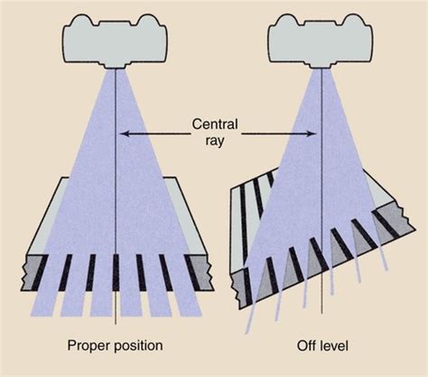 Grid Types Errors Flashcards Quizlet