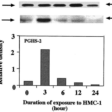 Hmc 1 Mast Cells Cocultured With Orbital Fibroblasts Up Regulates The Download Scientific