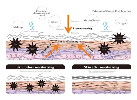 Omega Injection Tradekorea