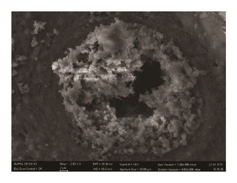 Sem Analysis Of Zno Deposited On Psf G Pst Membrane In The Presence Of Download Scientific