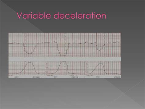 Ppt Labor And The Birth Process Powerpoint Presentation Free Download Id 2253749