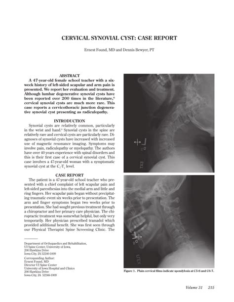 Pdf Cervical Synovial Cyst Case Report