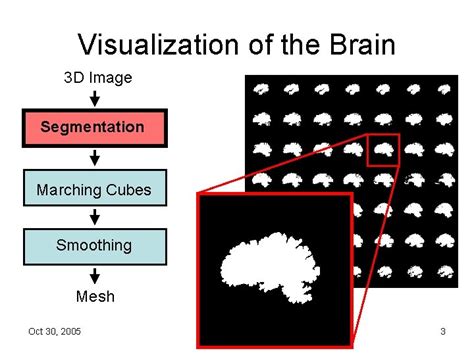 Open Topology A Toolkit For Brain Isosurface Correction