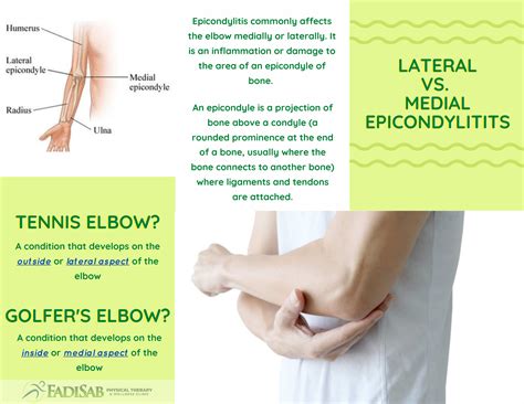 Epicondylitis Medial Vs Lateral Online Offers Gt
