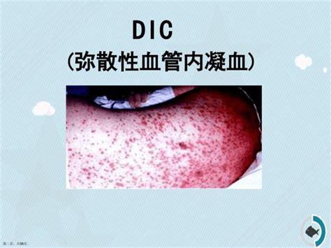 病理生理学概论和病因及发病学ppt 人人ppt