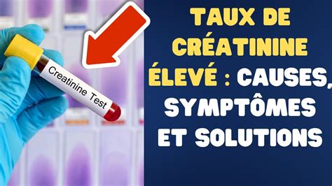 Taux De Créatinine élevé Causes Symptômes Et Solutions Fact24h