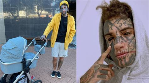 Dopo 200 Tatuaggi Di Cui 30 Sul Viso Un Giovane Inizia La Rimozione