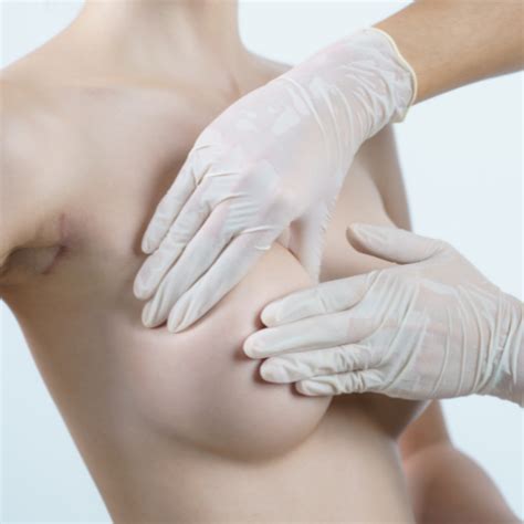 Adjacent Tissue Transfer Or Rearrangement Dr Finkel