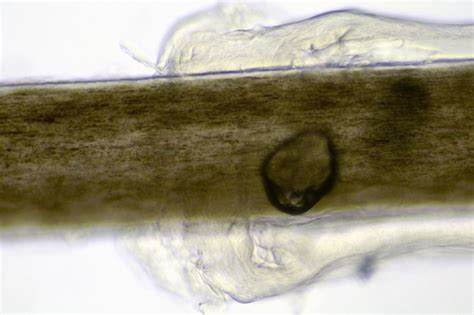 Hair Root Sheath Meddic