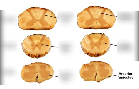 Diagram Of Spinal Vertebrae Transverse Section Quizlet