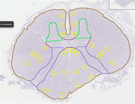 Pixel Classification By Script Image Analysis Imagesc Forum