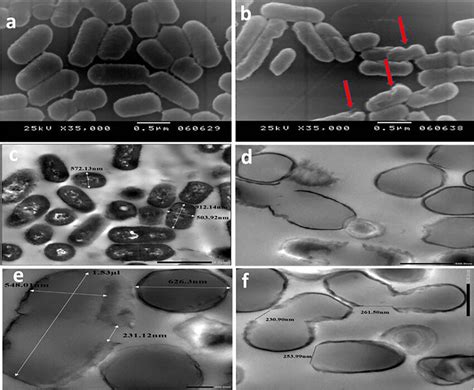 Electron Microscopic Characterization Of L Acidophilus Ghosts LAGs