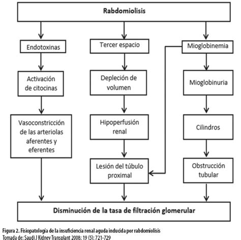 Insuficiencia Renal Aguda Inducida Por Rabdomiolisis