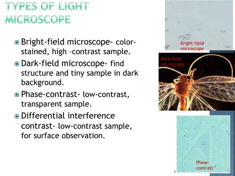 Bright Field Microscopy Principle And Applications Pptx Eye And Vision Conditions