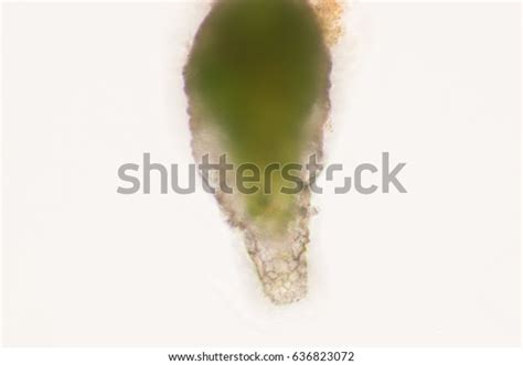 Difflugia Spprotozoa Under Microscope Stock Photo 636823072 Shutterstock