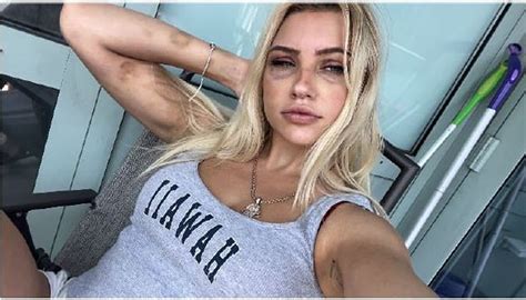Model Says Fifth Avenue Plastic Surgeon Ex Made Her Sex Slave And