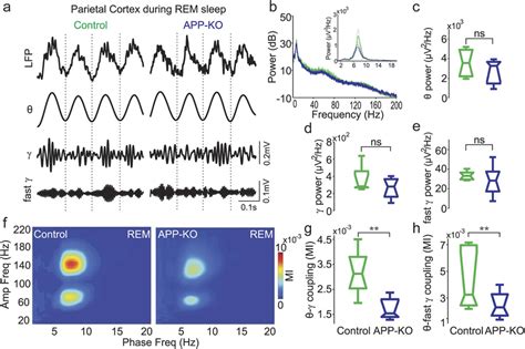 Lack Of App Also Affects Theta Fast Gamma Coupling In Parietal