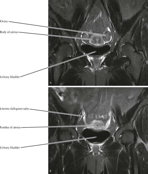 Pelvis And Perineum Radiology Key