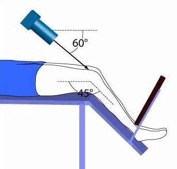 Radiographic Positioning Examples Of The Knee Patella Views Ce4rt