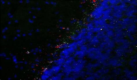 Rnascope® Multiplex Fluorescent Assay Optionsbio Techne Corporation