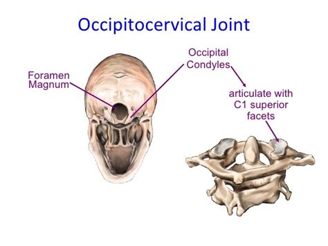 Occipital Condyle Anatomy