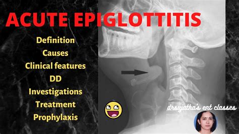 Epiglottitis X Ray
